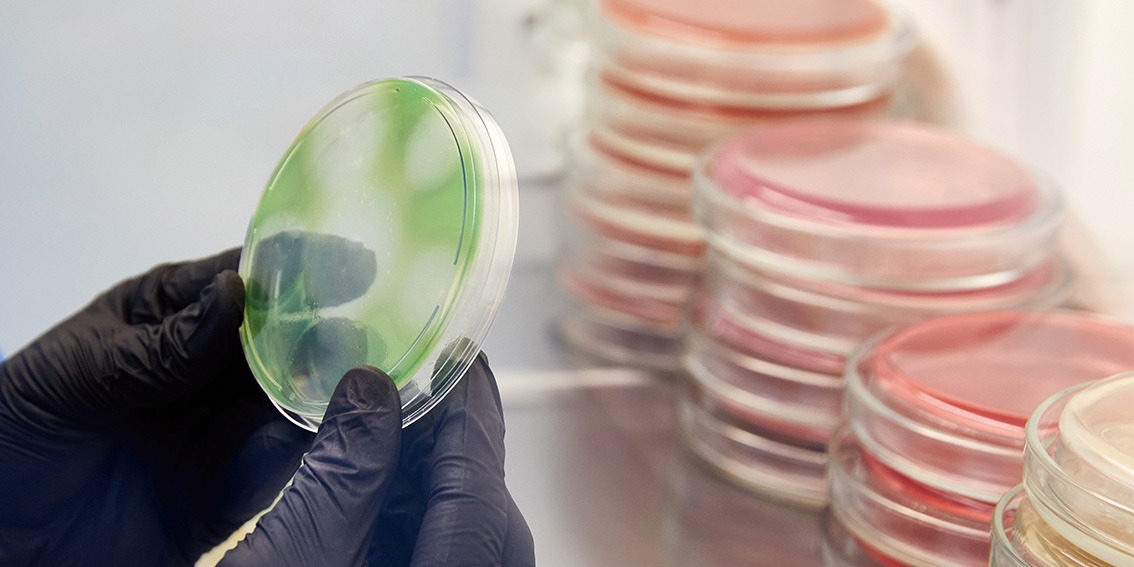 Media preparators for microbiology | RAYPA