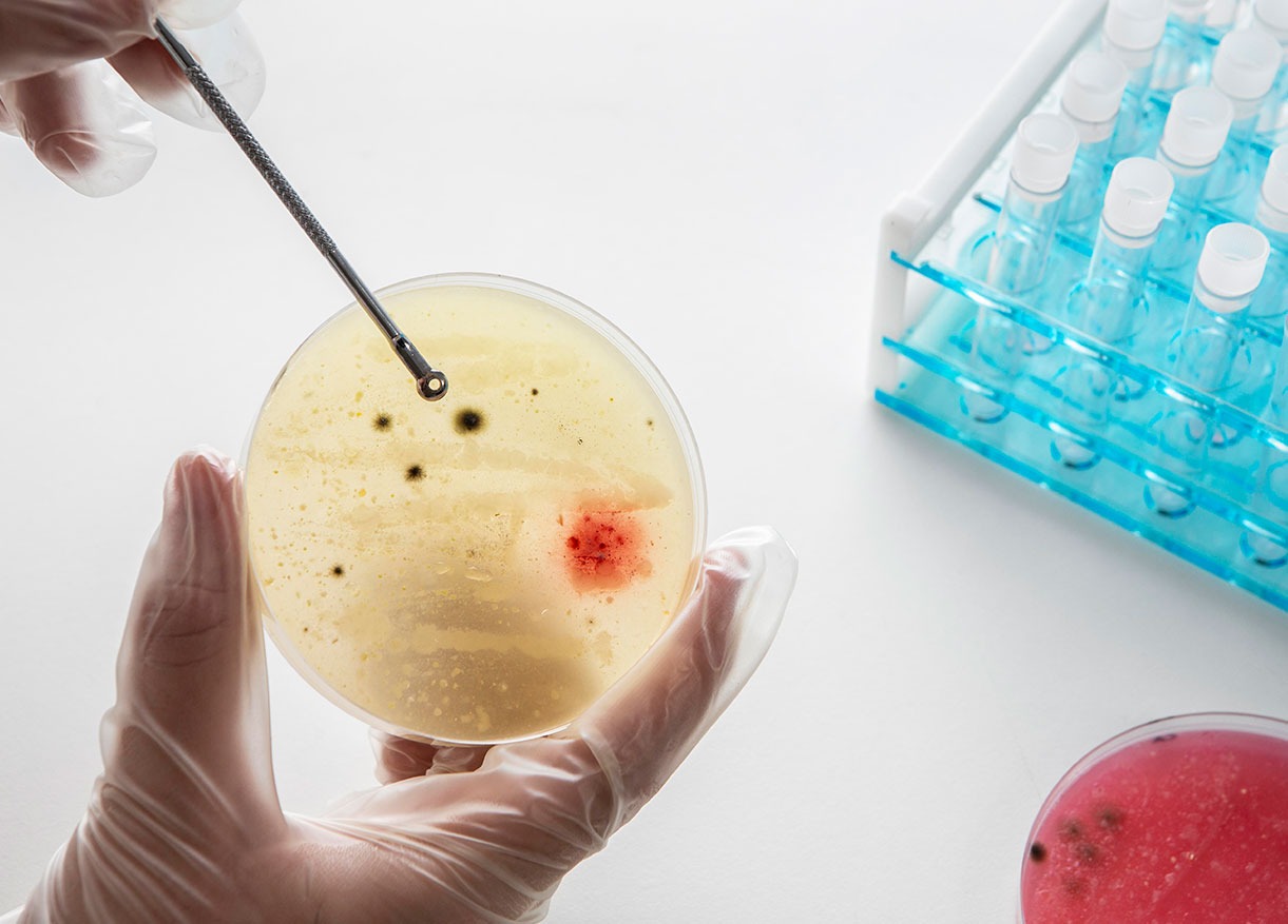 The F0 sterilization cycle in autoclaves | RAYPA